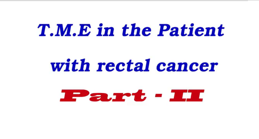 TME in the patient with rectal cancer - عمل کانسر رکتوم به روش TME